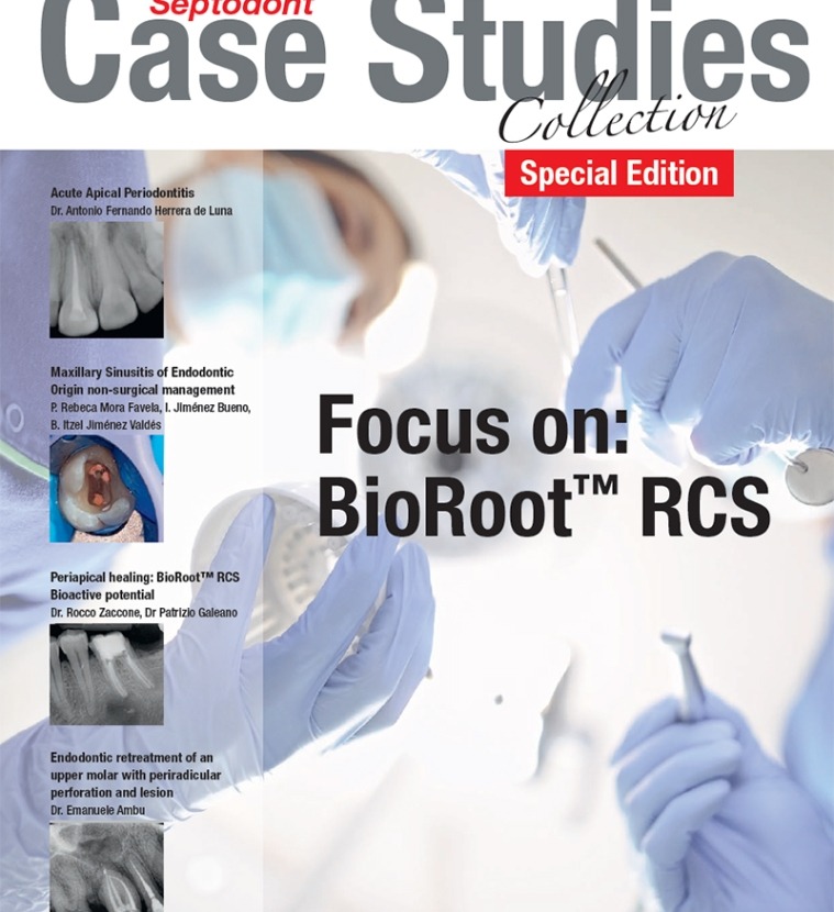 Case Studies Collection Special Edition Focus on BioRoot® RCS - Septodont