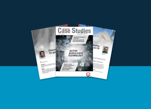 Septodont USA | Local dental anesthesia and dental therapeutics